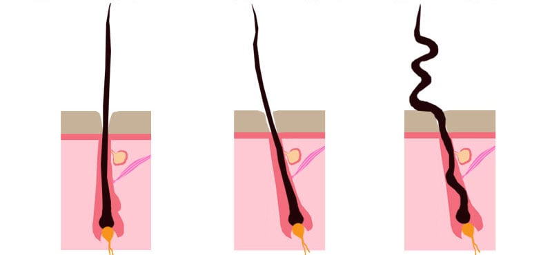 Ethnicity Hair Types - Asmed Hair Transplant